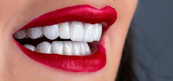 Full Set of Veneers Cost | Casey Dentists