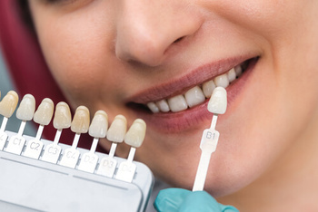Veneers for Overlapping Teeth | Casey Dentists